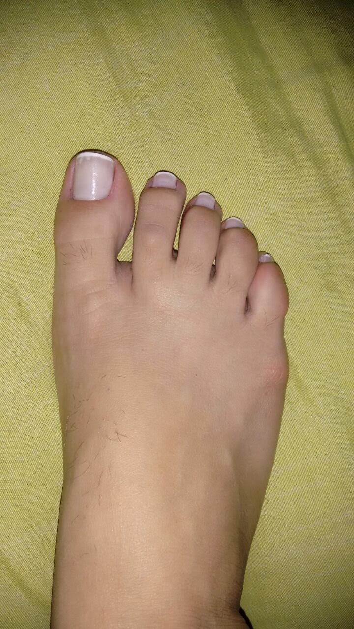 Podolatria Feet BH: 2014