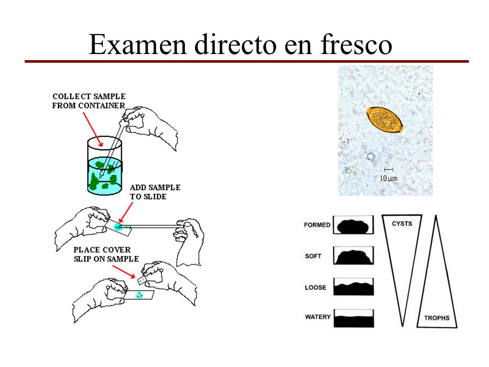 Equipo 5: Técnicas parasitológicas mas comúnes: Técnicas ...