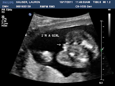 TheHauserHaus: New Baby Girl - Anatomy Scan @ Riverside