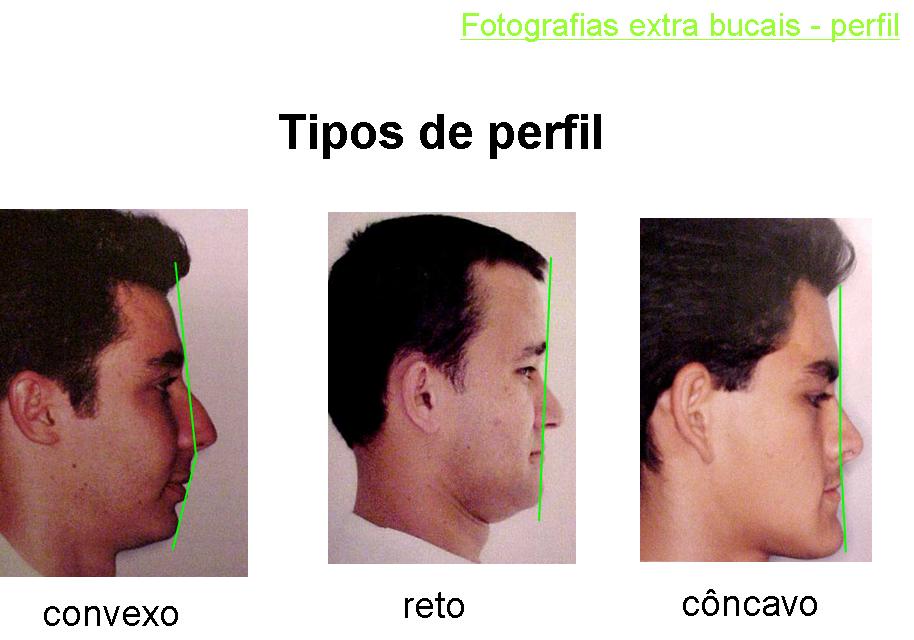 Curso de Ortodontia APCD Pinheiros: Março 2011