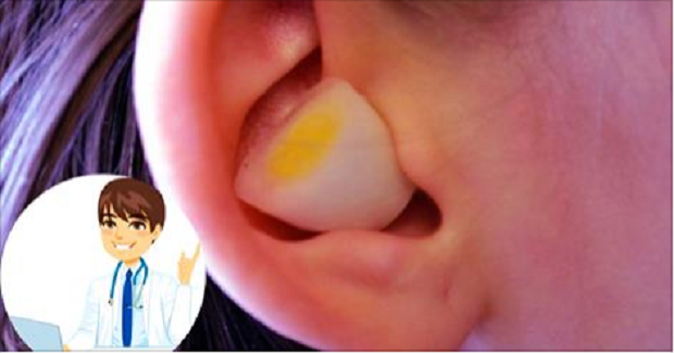 This Is What Happens When You Put Garlic In Your Ear Overnight