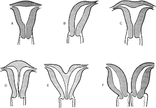 THE JOURNEY: SHG and MRI