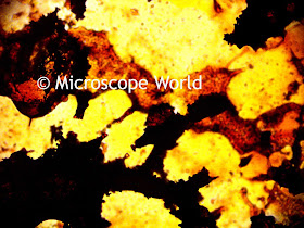 Microscope World Blog: Tuberculosis under the Microscope