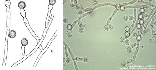 Micosis Humana: Estructura