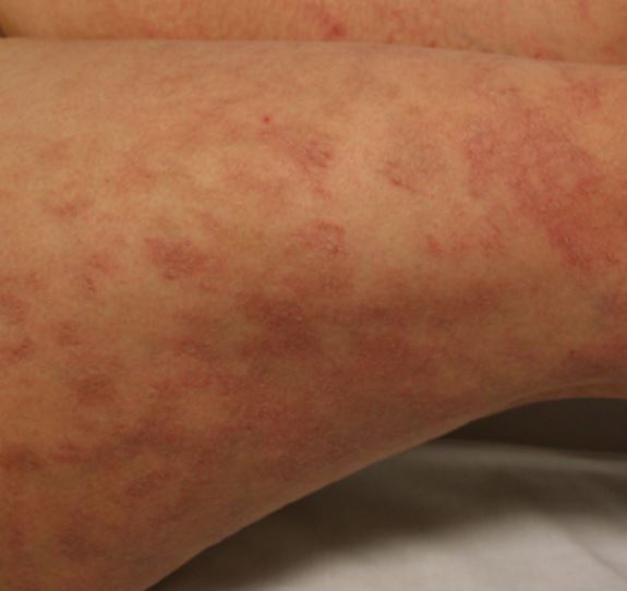 Uidumõtteid ja juhtumisi: Huatulco Needus 5 - Parasiidid, putukad ...