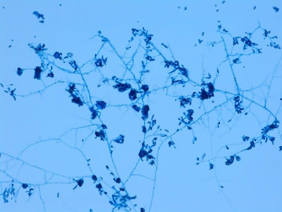Fun With Microbiology (What's Buggin' You?): Scopulariopsis brevicaulis