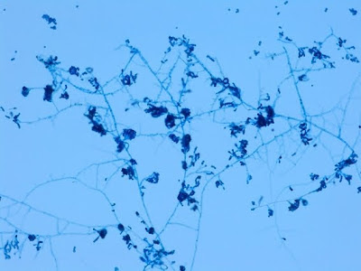 Fun With Microbiology (What's Buggin' You?): Scopulariopsis brevicaulis