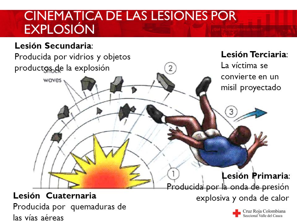 Video: Lesiones por explosion (Sucre).....