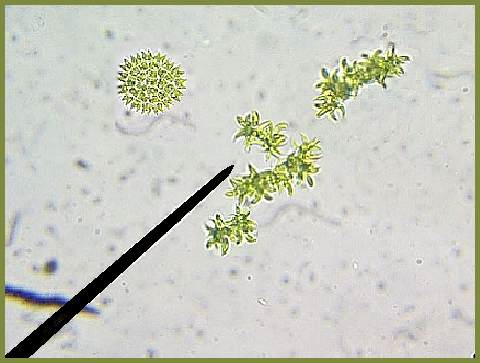 Scenedesmus Under Microscope