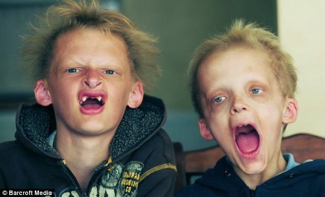 Latinski jezik za medicinske škole: EKTODERMALNA DISPLAZIJA