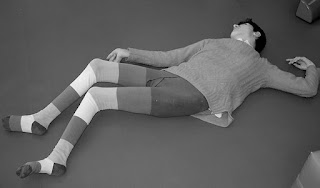 Trastornos del movimiento, Disquinesia (distonía,coreoatetosis ...