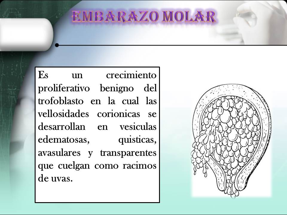 embarazo molar