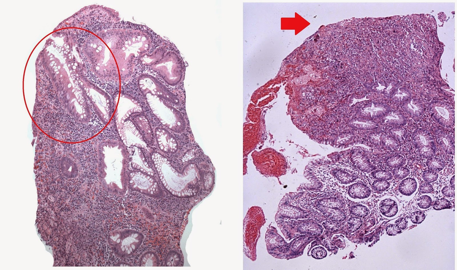 GASTROINTESTINAL AND LIVER HISTOLOGY PATHOLOGY ATLAS: COLON ...