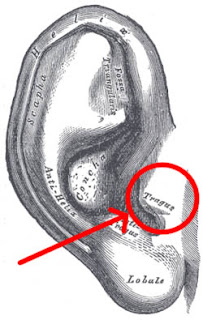 Duda's Epic Quest To Epicness: The Tragus!