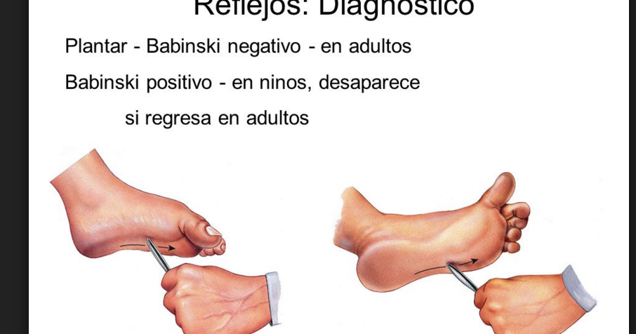 Anatomía Aplicada: Reflejo plantar, reflejo de Babinsky
