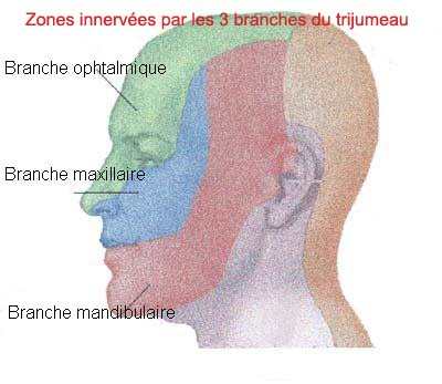 La névralgie du trijumeau | Récap' IDE