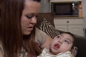 Watch : Baby Born Without A Brain