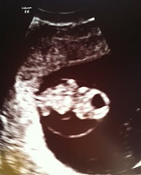 The Pregnant Housewife: Dynamic Cervix Update