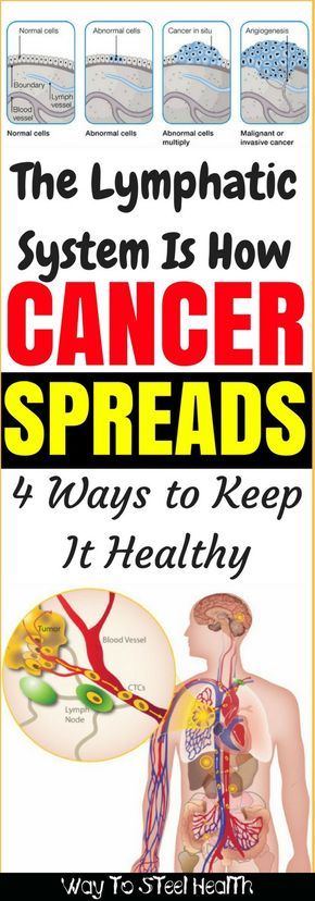 The Lymphatic System Is How Cancer Spreads: 4 Ways to Keep It Healthy ...