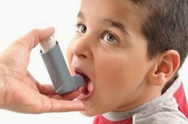 4 Obat Herbal untuk Asma yang Mudah Dijumpai - Cara Merawat Kulit Wajah