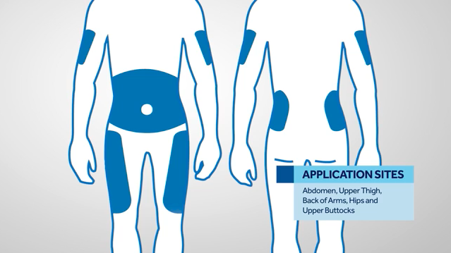 Chegou o i-Port: a porta de entrada para a insulina!