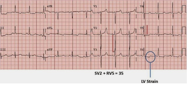 doctor's blog: Bimbingan EKG IPD-15