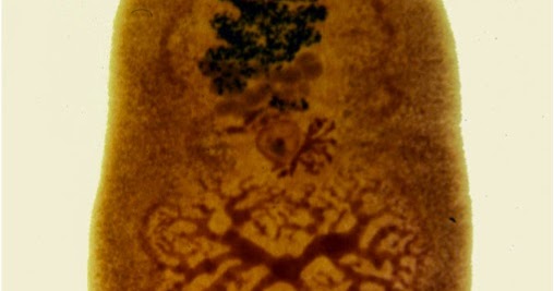 Lecture Notes in Medical Technology: Lecture #9: THE INTESTINAL FLUKES