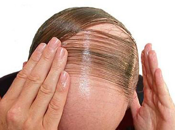 Understanding Bald - Home of Health