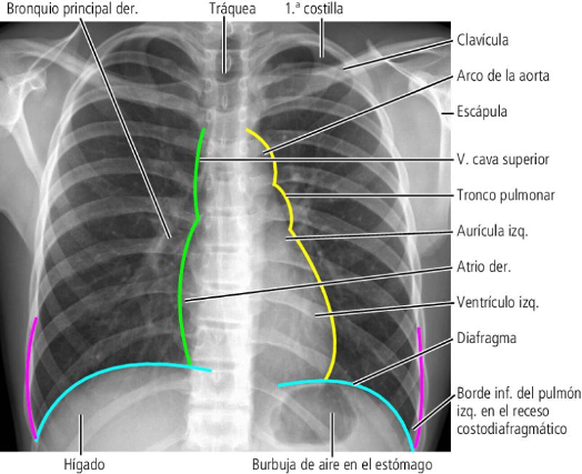 SILUETA CARDIACA-RX