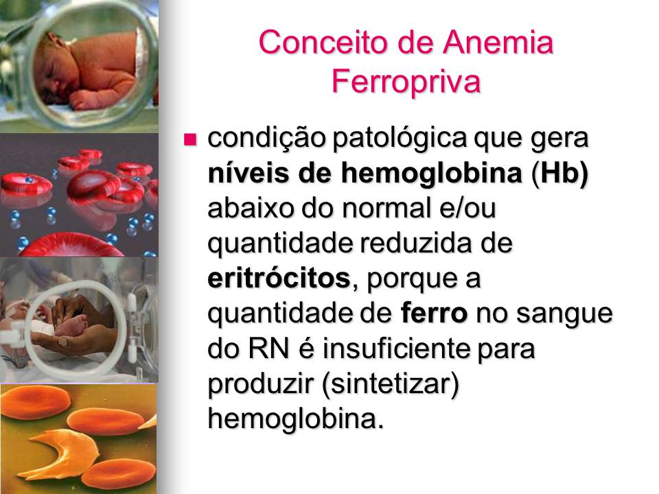 Enfermagem, aprendendo, realizando e ensinando o cuidado: Anemia Neonatal