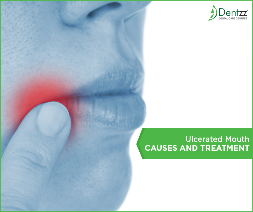 Oral health treatment and consultation by Dentzz Dental: Dentzz ...