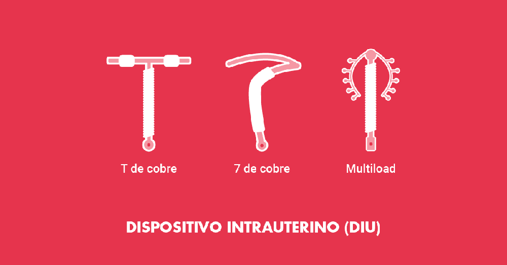 SaltimbanquiClicClic: El DIU puede proteger contra el cáncer uterino