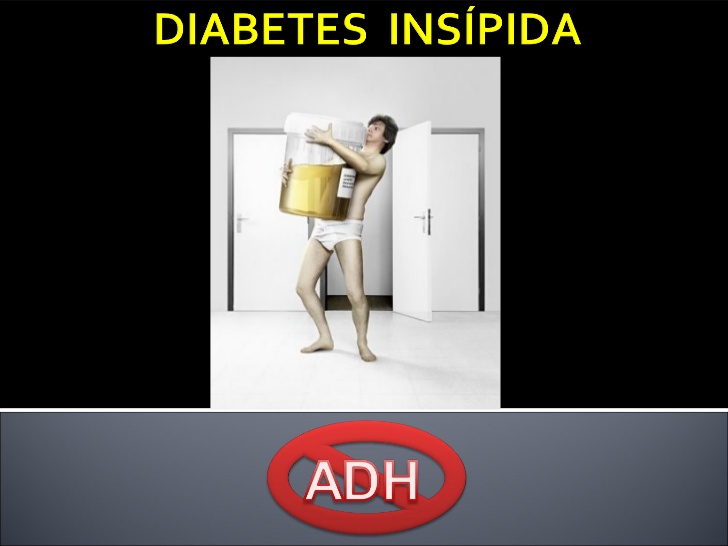 DIABETES INSIPIDA ~ CONSULTAS MEDICAS ONLINE