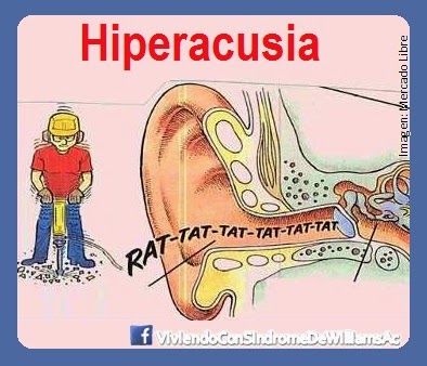 Hiperacusia en términos sencillos | Nosotros viviendo con síndrome de ...