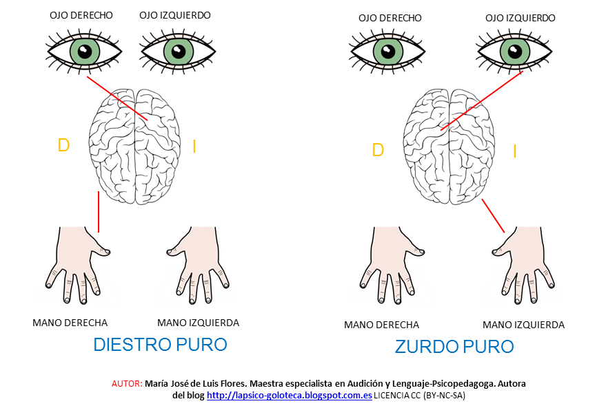 UNA PT EN LAS NUBES: Lateralidad Cruzada