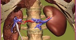 askep gagal ginjal kronik (GGK)