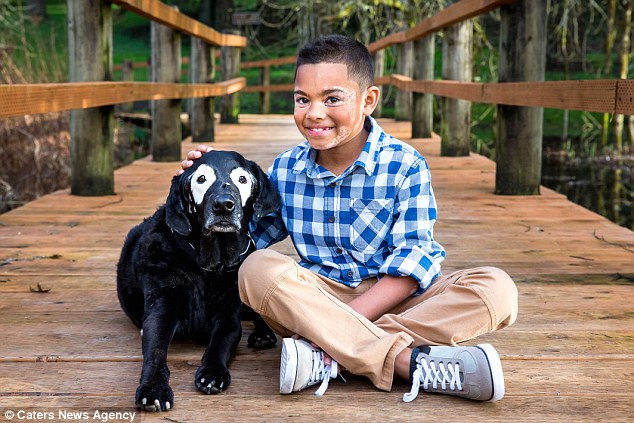 White Wolf : Boy with a rare skin disorder hates his looks, until he ...