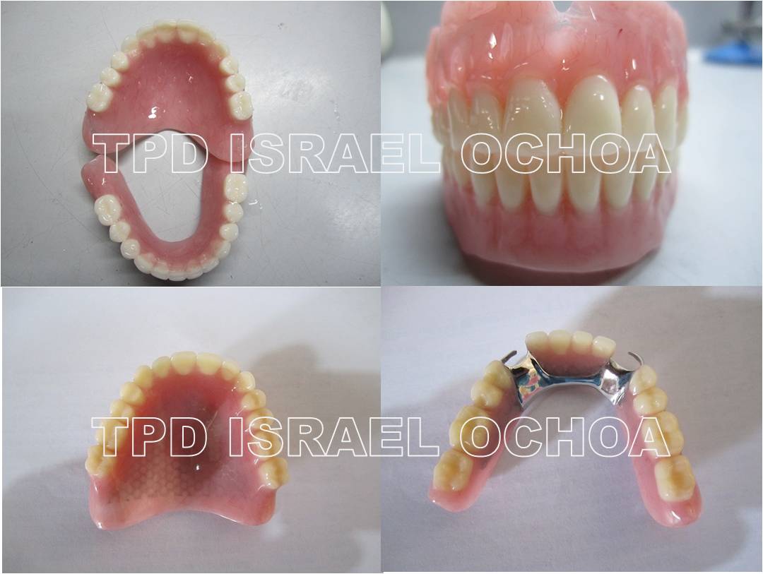 Protesis Totales ~ Lab Dental Israel