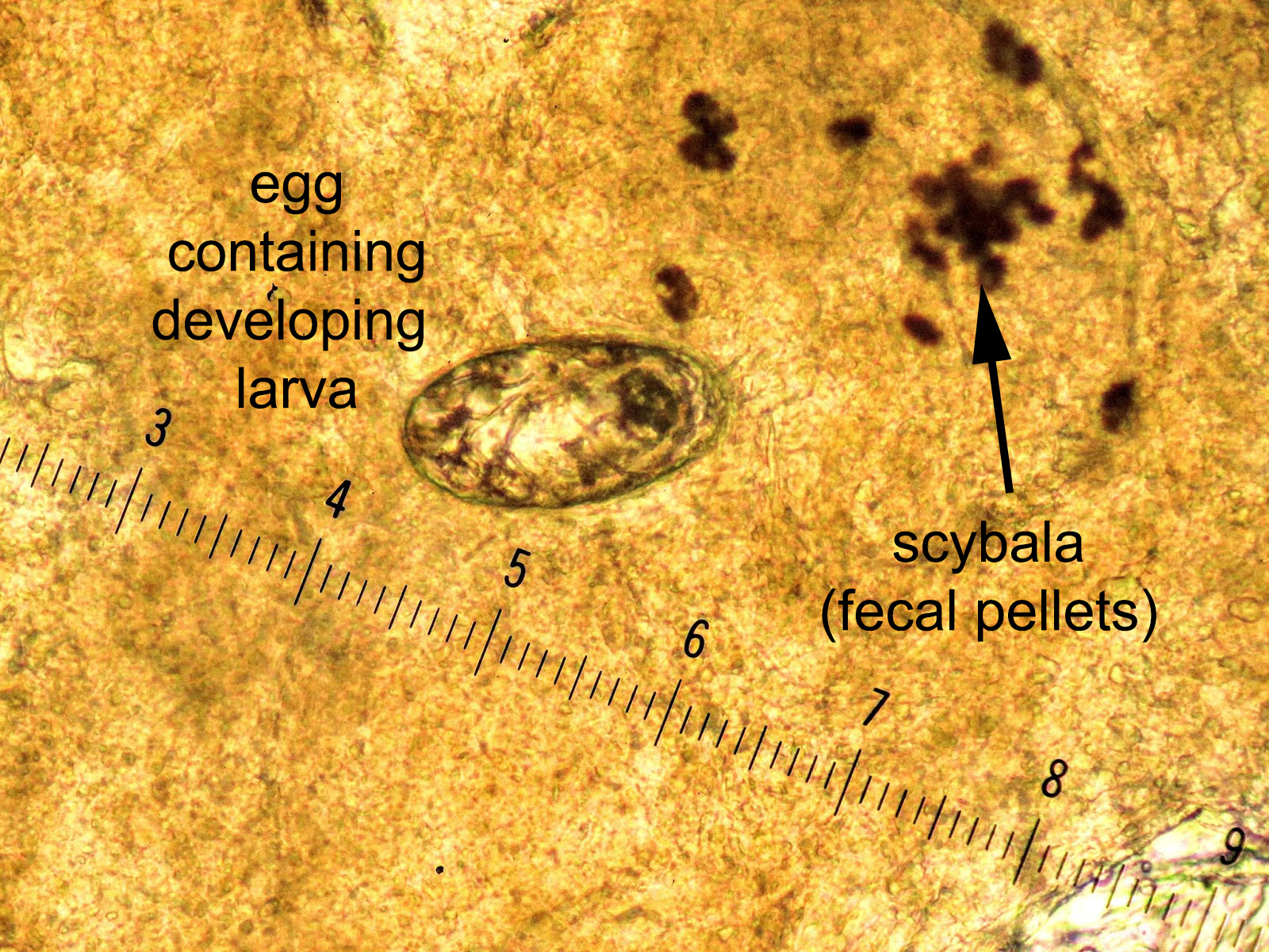 Scabies Eggs Under Microscope