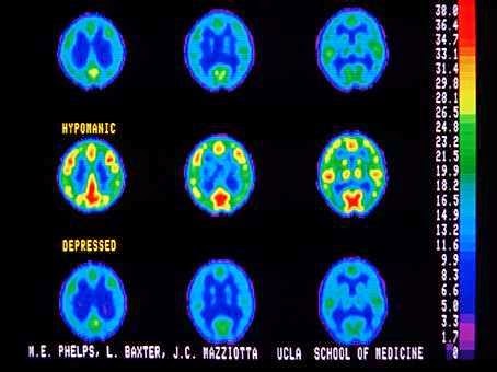 Taming the Polar Bears: Bipolar, the Brain and Energy - Part Two