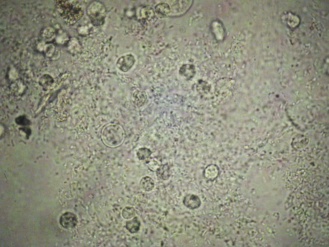 Piócitos Na Urina 3 Por Campo - RETOEDU