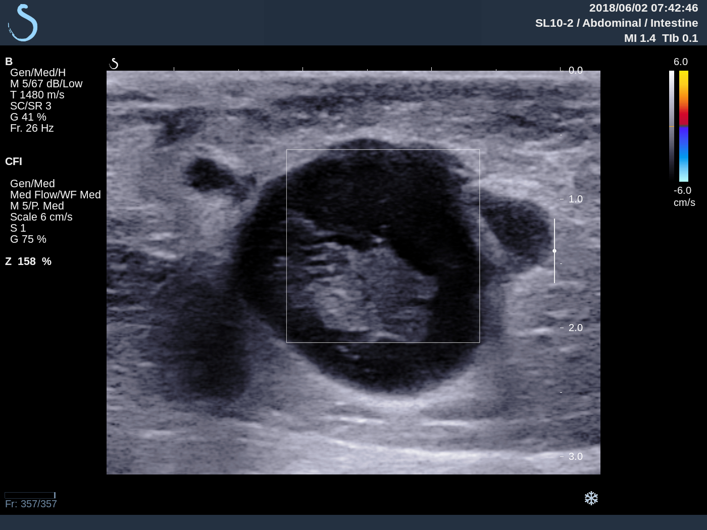 VIETNAMESE MEDIC ULTRASOUND: CASE 497: MULTIPLE SKIN LESIONS AND ...