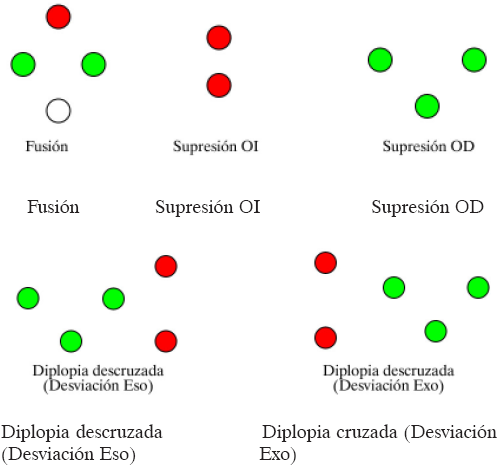 Test empleados en optometria : LUCES DE WORTH