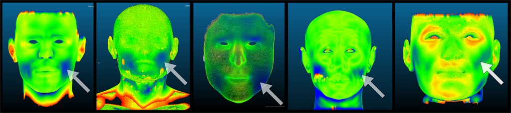 ATOR: Digital facial reconstruction - blind tests and practical ...