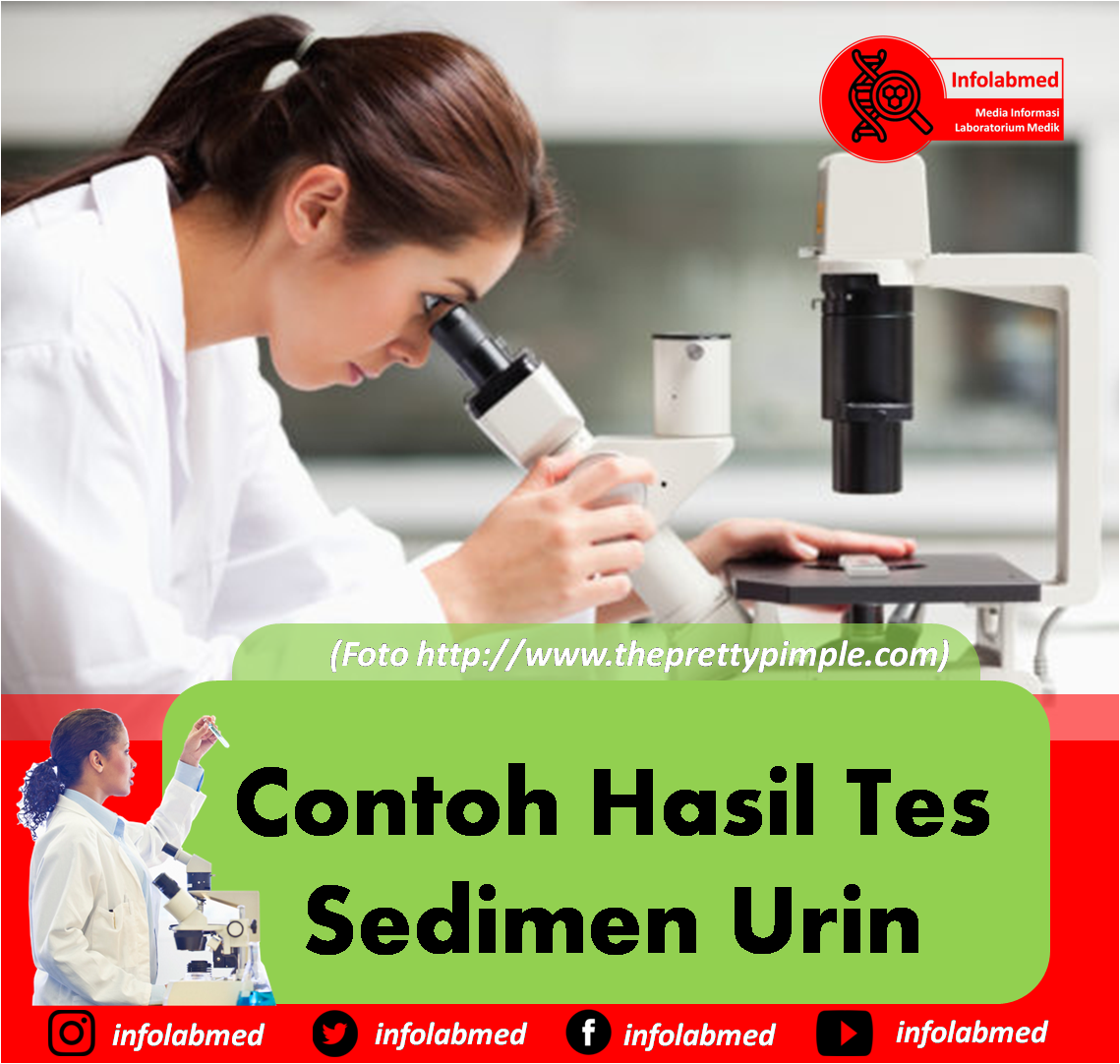 Contoh Hasil Tes Sedimen Urin