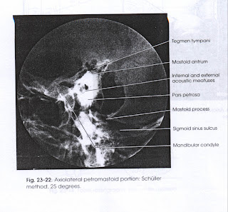 DERAMA: SKULL RADIOGRAFY