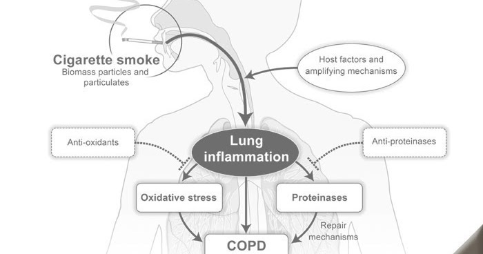 Chronic Obstructive Pulmonary Disease: Pathogenesis