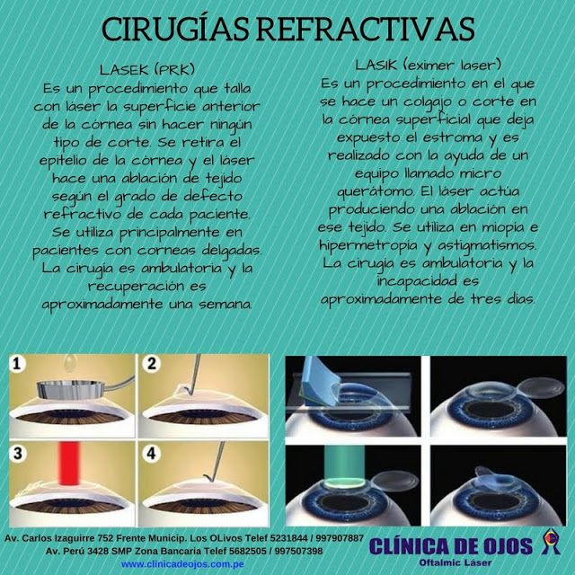 Clínica De Ojos Oftalmic Láser CirugÍa Refractiva Con Laser Lasik Y Prk
