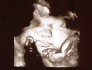 Count Your Blessings: 38 weeks ultrasound pictures