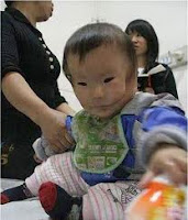 Meet Zhao Huikang: the two-faced baby